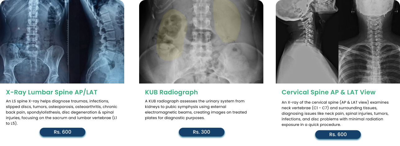 X-Ray – Lifecare